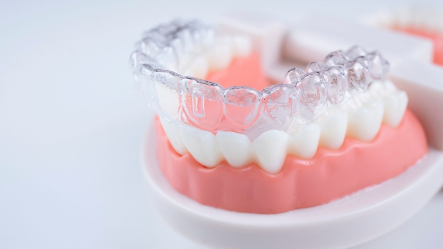 Invisalign: The Modern Way to Invest in a Confident Smile - Heritage ...